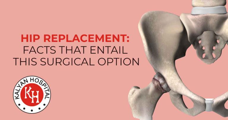 Hip Replacement: Facts That Entail This Surgical Option