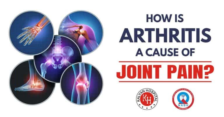 Arthritis: cause of joint pain
