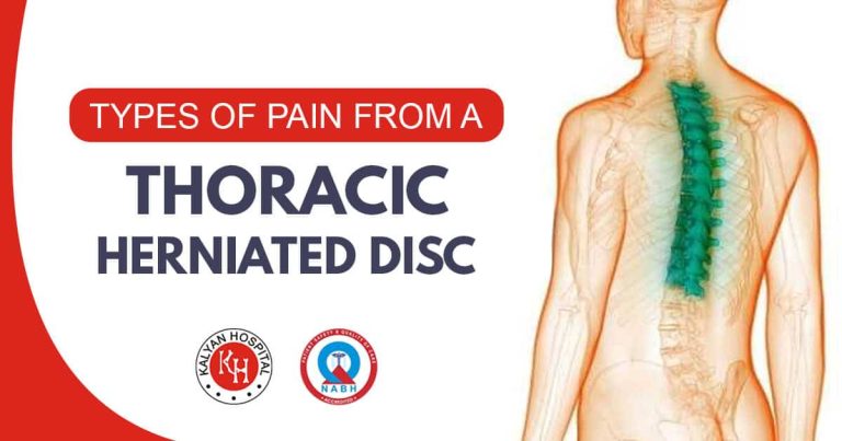 How a Herniated Disc in Your Upper Back Causes Pain